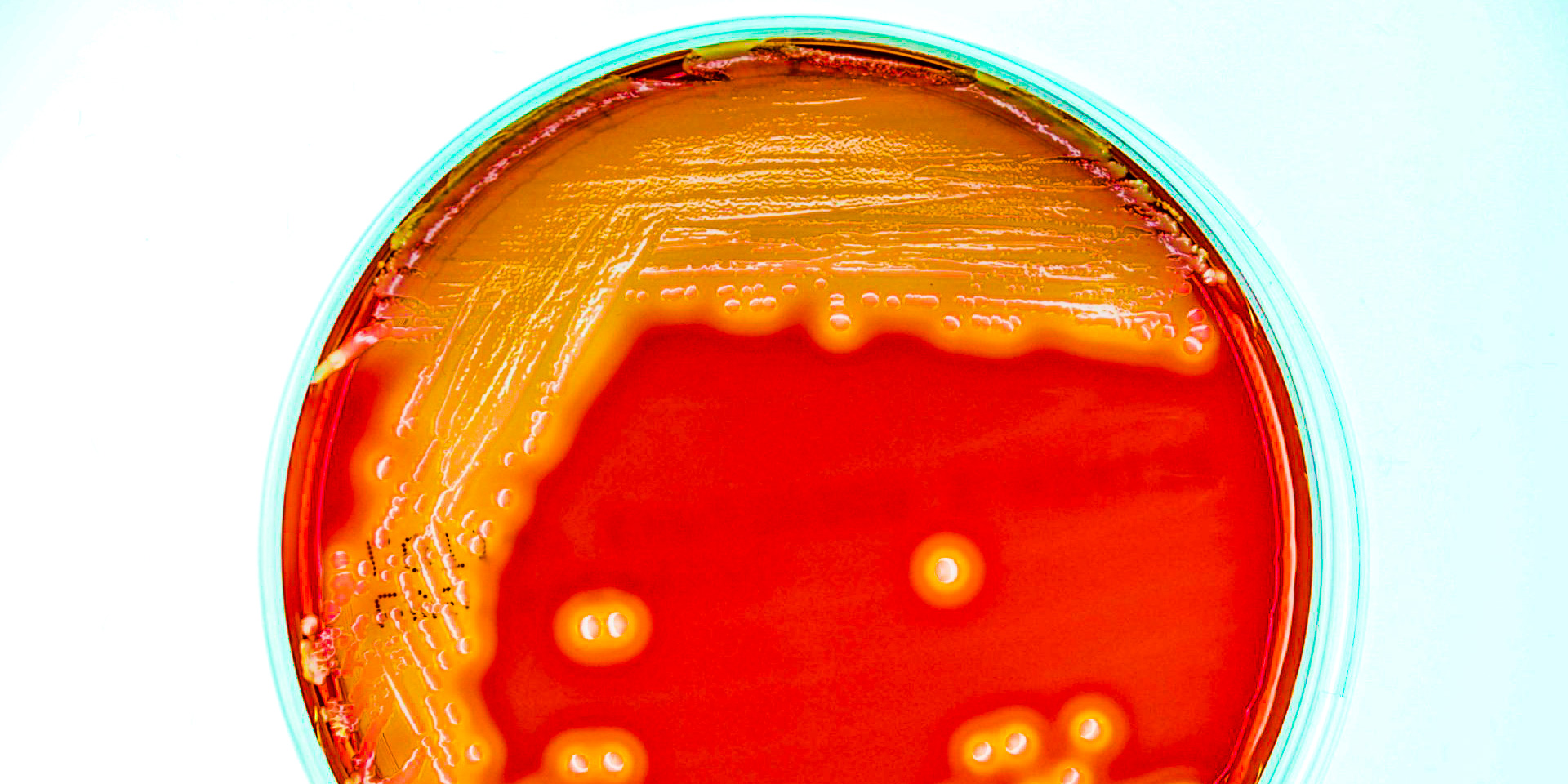 Mold Testing in Maryland Real Estate under the New Law | Green Building ...